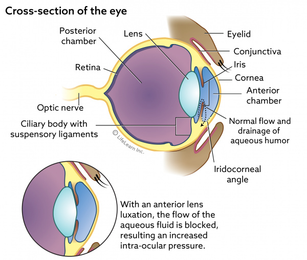Lens Luxation in Dogs | VCA Animal Hospital