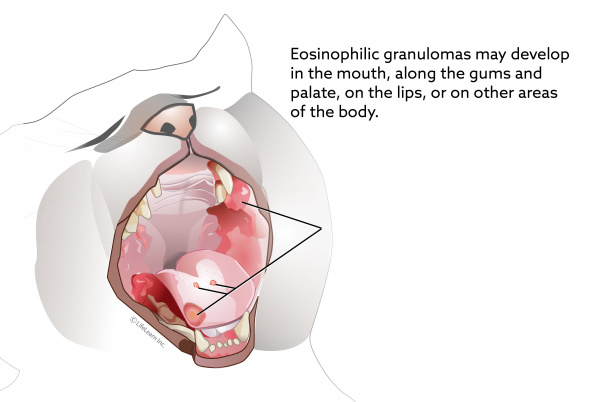 Eosinophilic Granuloma Complex in Cats | VCA Animal Hospital
