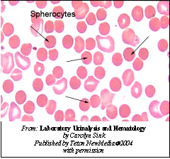 Coombs' Test | VCA Animal Hospital