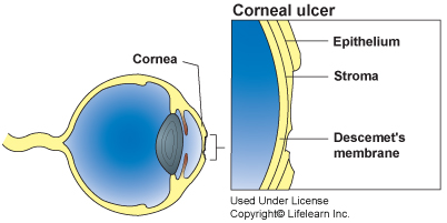 Corneal Ulcers in Cats | VCA Animal Hospital