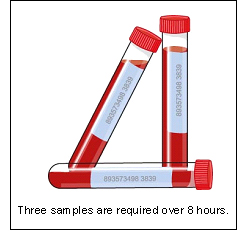 Dexamethasone Suppression Tests | VCA Animal Hospital