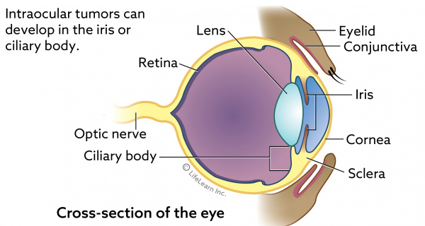 Eye Tumors - Primary Intraocular Tumors | VCA Animal Hospital