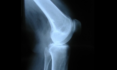 Radiographs for Dogs | VCA Animal Hospital