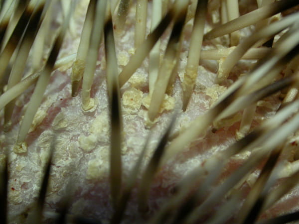 Hedgehogs - Diseases | VCA Animal Hospital