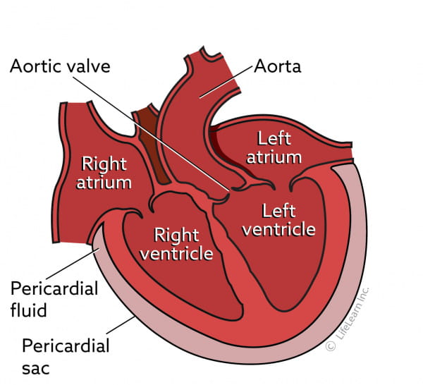 Pericardial Effusion in Dogs | VCA Animal Hospital
