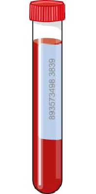 Trypsin-like Immunoreactivity | VCA Animal Hospital